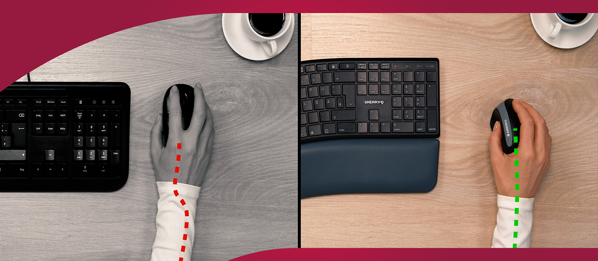 Laptop Ergonomic Wrist Position Macally X9 Performance Split Ergonomic